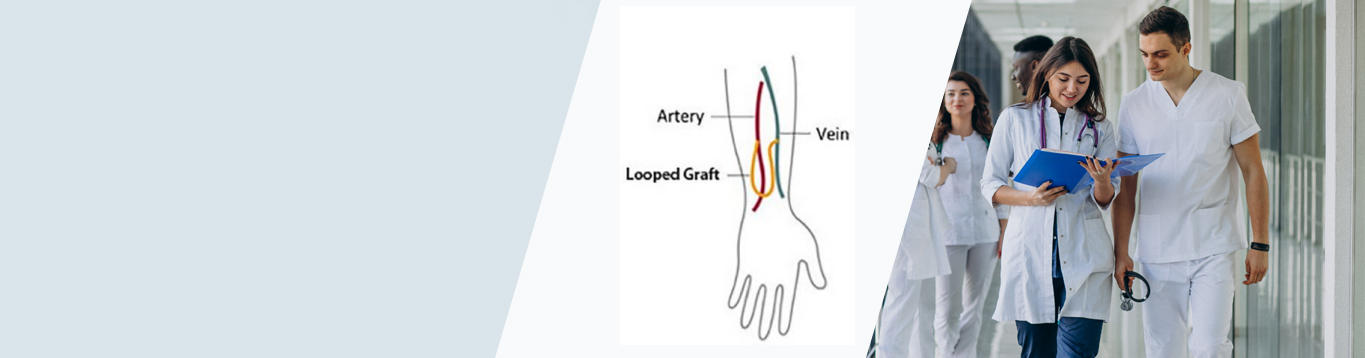Arterio-Venous FISTULA [AVF] - Varicose Vein Treatment | Specialist ...